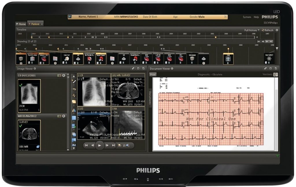 Philips IntelliSpace Cardiovascular | Verwaltungssoftware | Böhm ...
