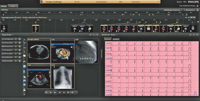 Philips IntelliSpace Cardiovascular | Verwaltungssoftware | Böhm ...