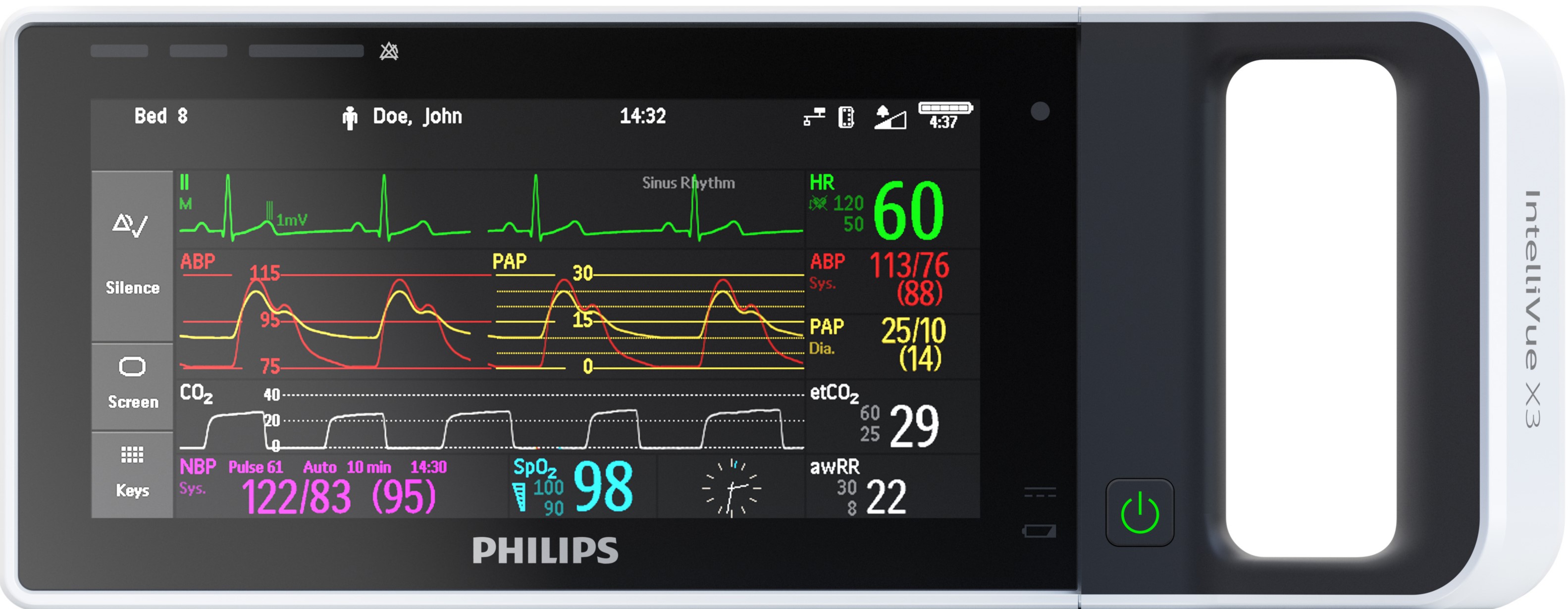 867030-IntelliVue-X3-Patientenmonitor horizontale-Darstellung | Böhm ...